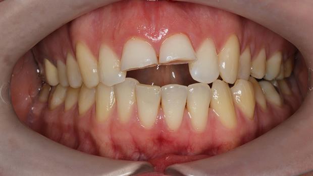 Dental Trauma UK - Home